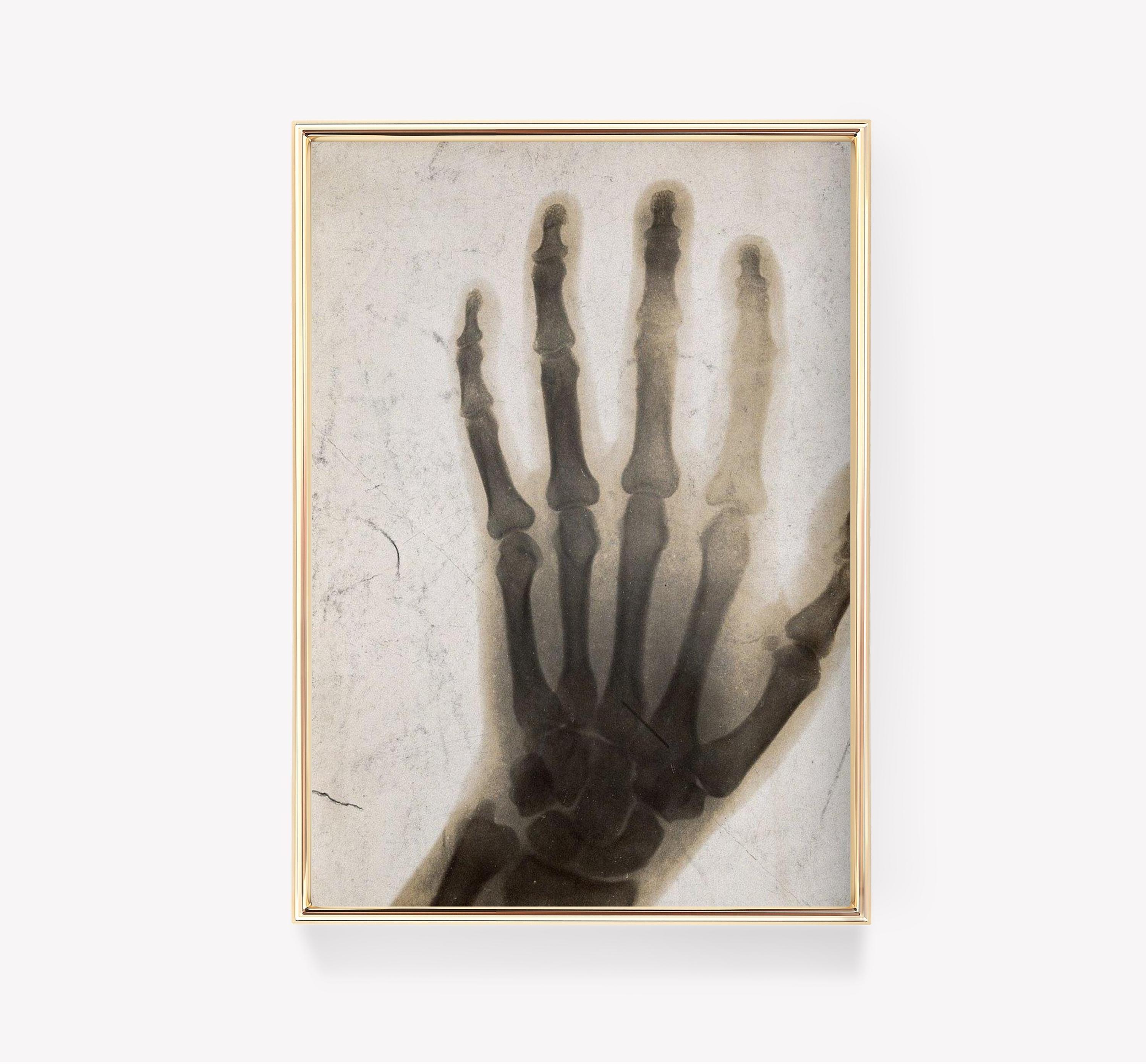 X Ray Hand Art Wilhelm Rntgen Vintage Limited Edition Posters (No Frame)